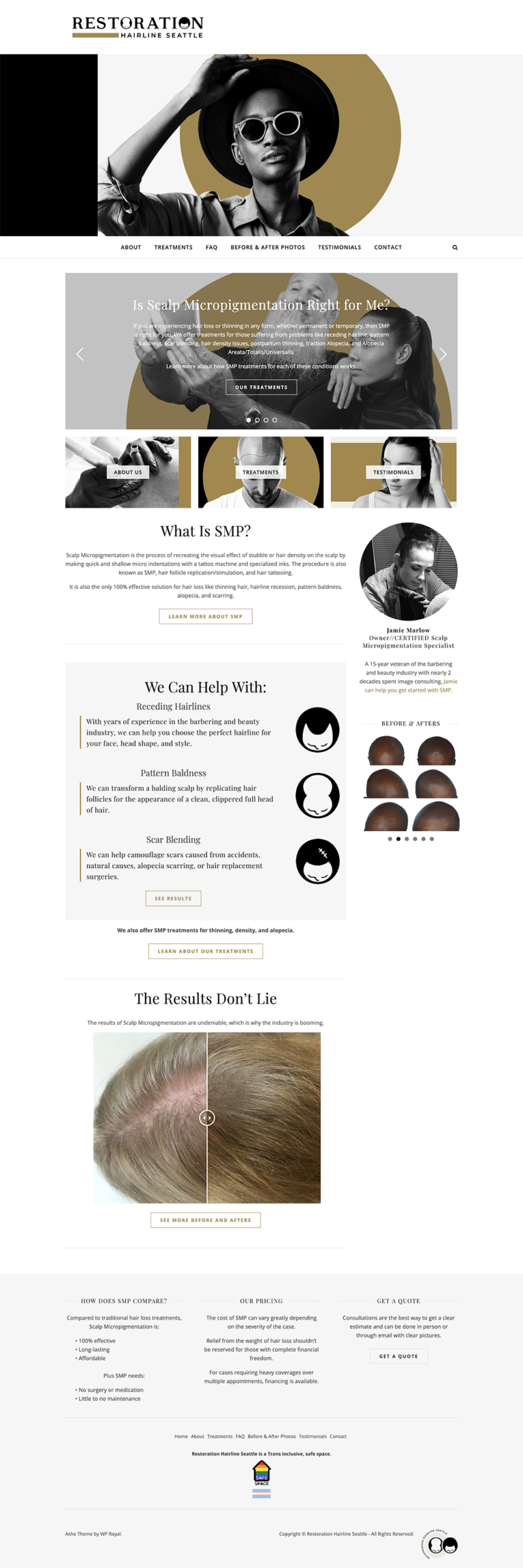 Restoration Hairline Seattle – Allison Shields' Portfolio